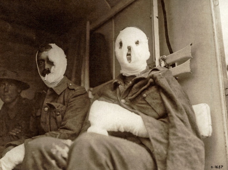 WW1 Wounded, Medical Advances and War Pensions | Kingston upon Hull War ...